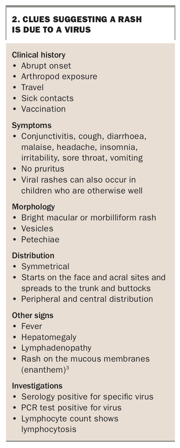 Viral Exanthem Chart National Guidance For The Management Of Children